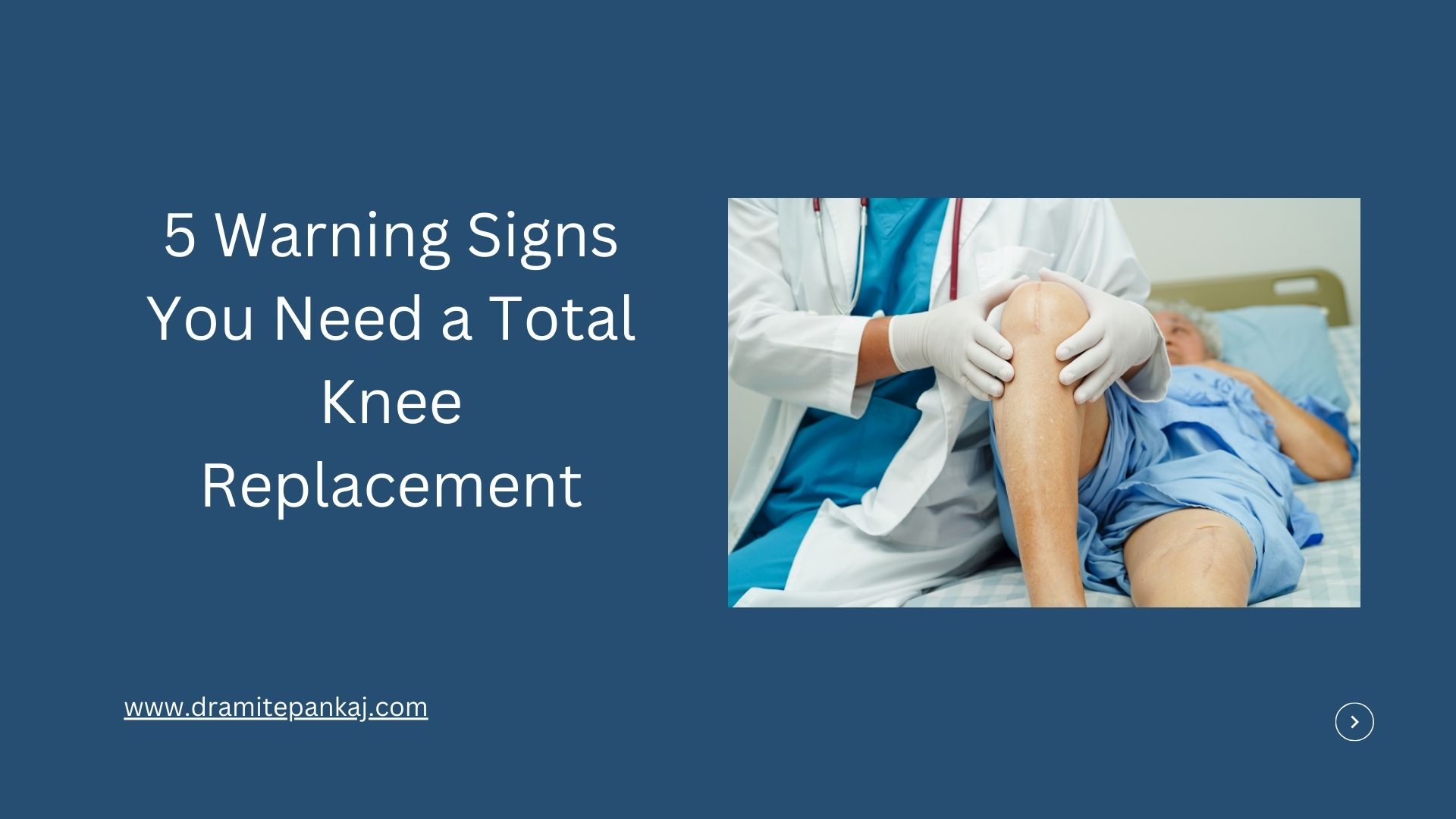 5 Warning Signs You Need a Total Knee Replacement