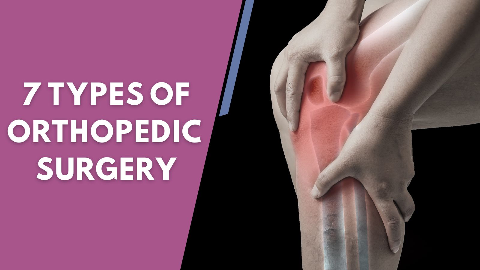 Orthopedic Surgery: Overview & Types - Dr Amite Pankaj Aggrawal