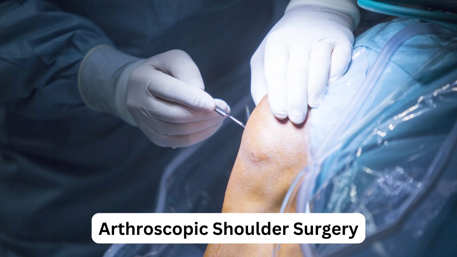 Arthroscopic Shoulder Surgery: What It Is and Is It Worth Considering ...