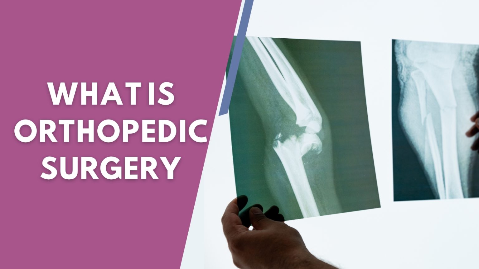 Orthopedic Surgery: Overview & Types - Dr Amite Pankaj Aggrawal